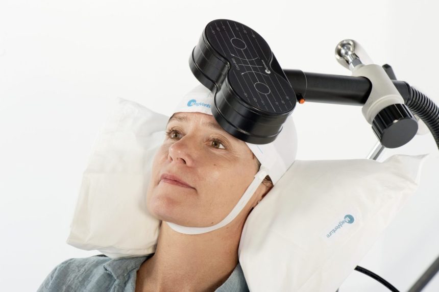 Estimulación Magnética Transcraneal en Depresión Mayor - Atención ...